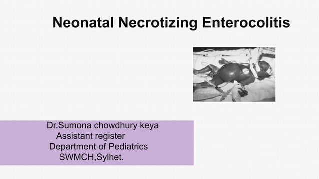 Neonatal Necrotizing Enterocolitis | PPTX | Digestive Disorders ...