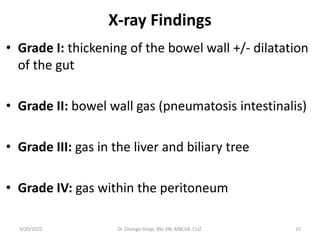 Neonatal Necrotizing Enterocolitis (NEC).pdf