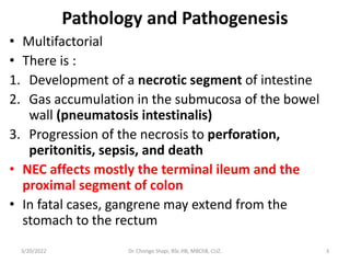 Neonatal Necrotizing Enterocolitis (NEC).pdf