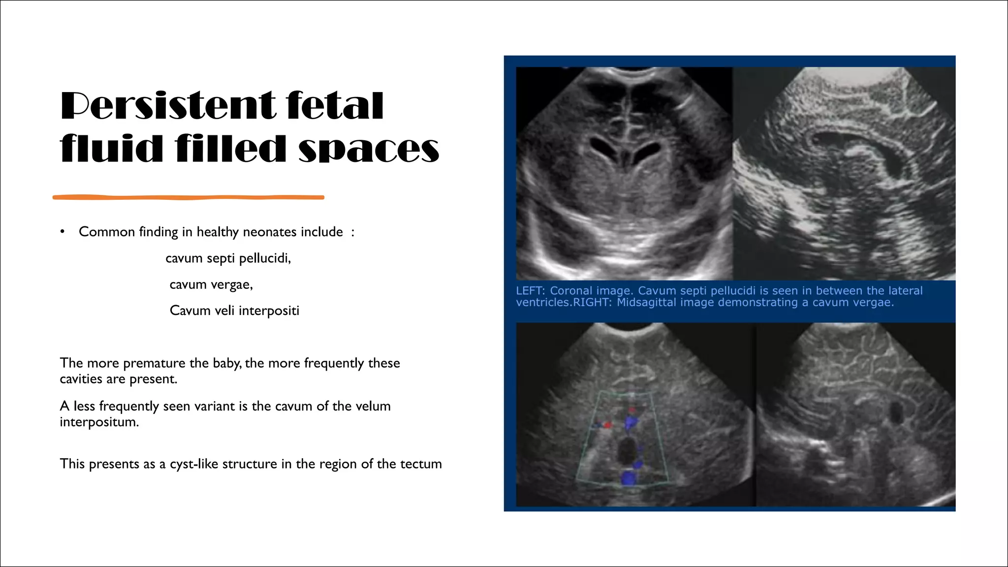 Neonatal neurosonography | PDF