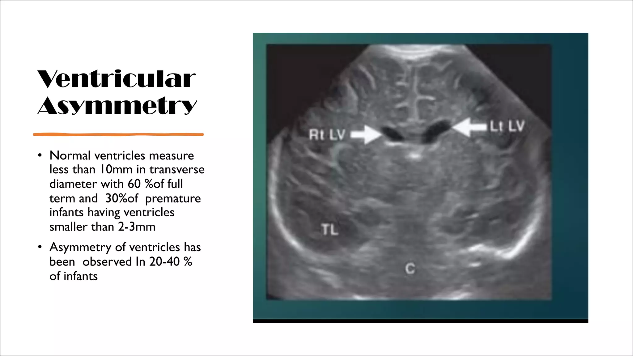 Neonatal neurosonography | PDF