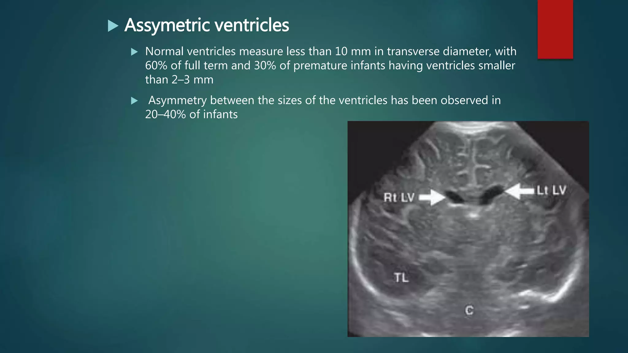 Neonatal neurosonography | PPTX
