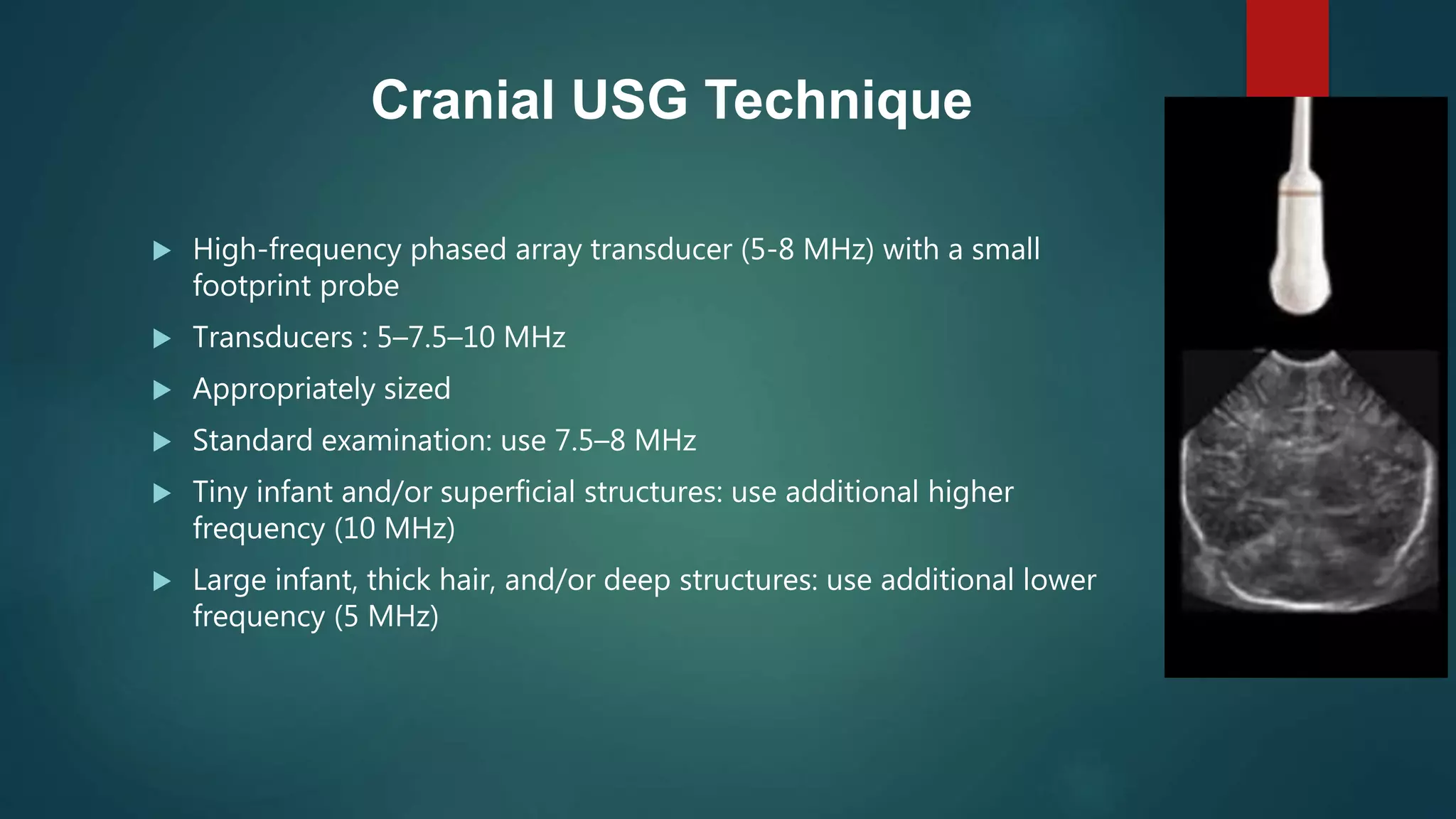 Neonatal neurosonography | PPTX