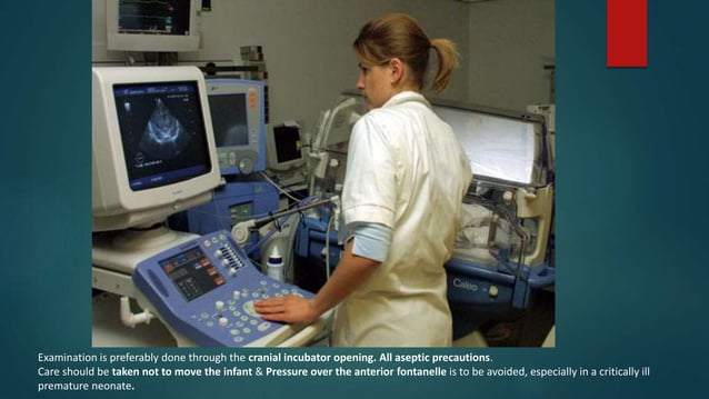Neonatal neurosonography | PPTX