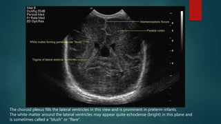 Neonatal neurosonography | PPT