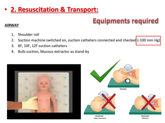Neonatal Nursing of Extremely Premature Neonates - Dr Padmesh | PPT