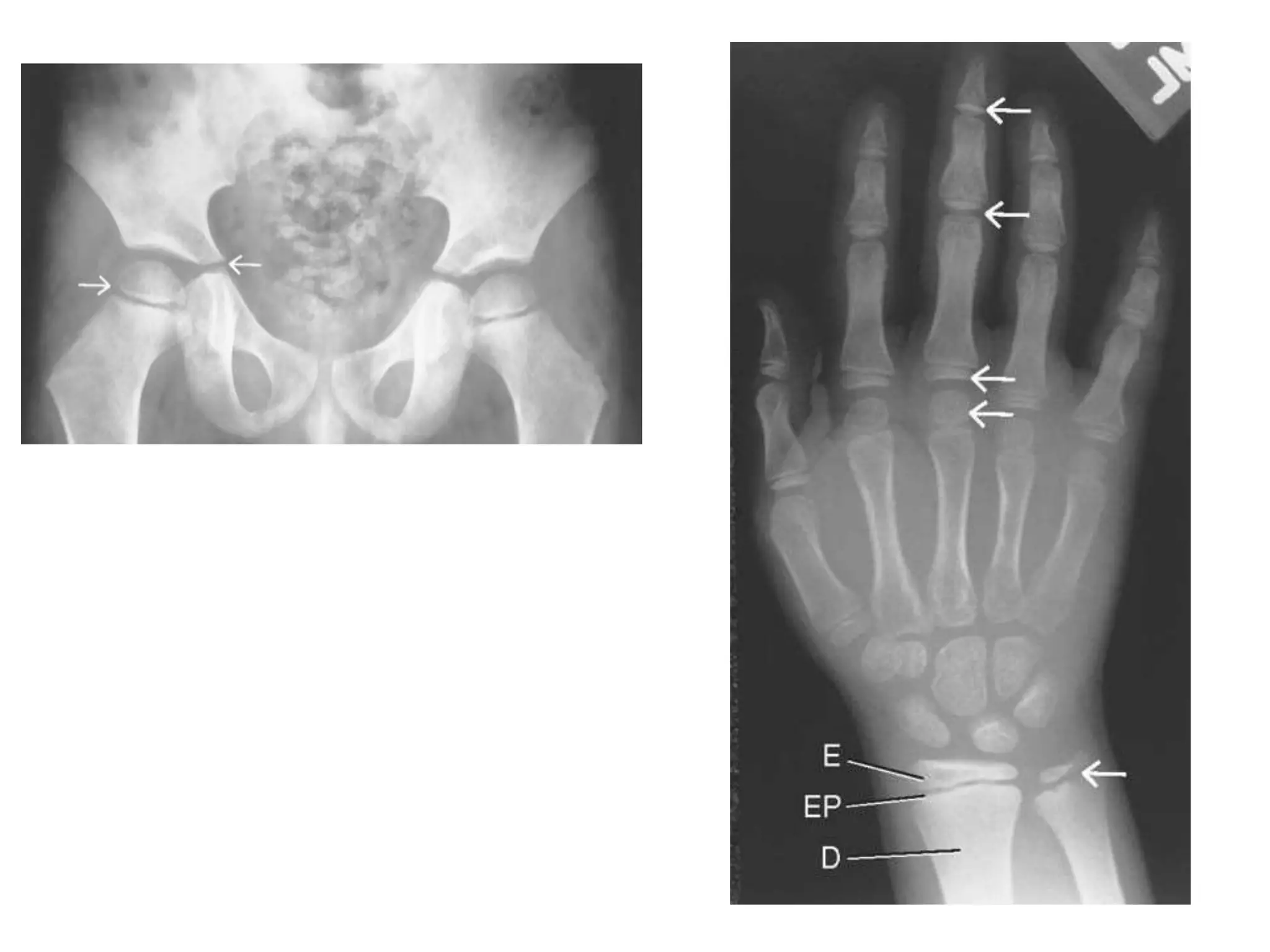 Neonatal or and pediatric radiography | PPTX