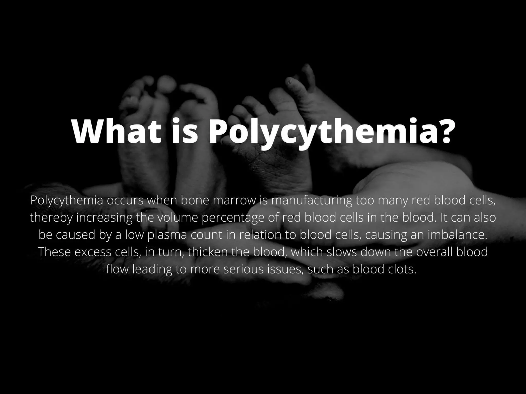 An Overview: Neonatal Polycythemia | PPTX