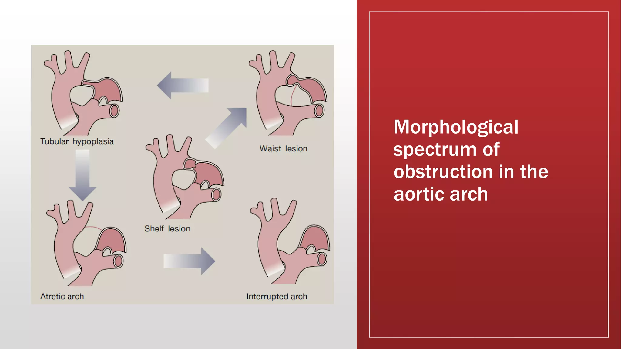 Neonatal presentation of congenital heart diseases- Dr. Sankha ...