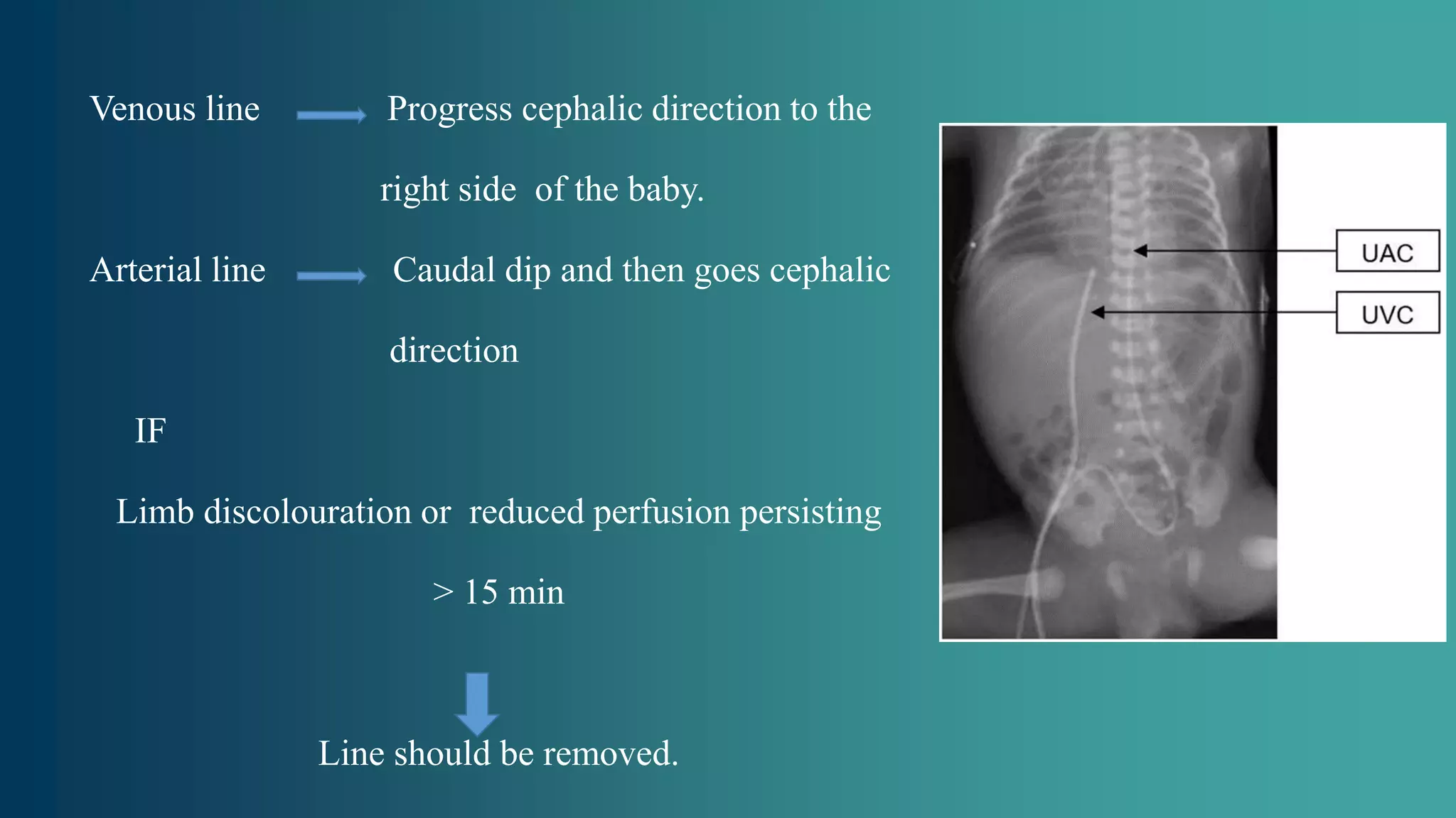 Neonatal procedures final | PPTX