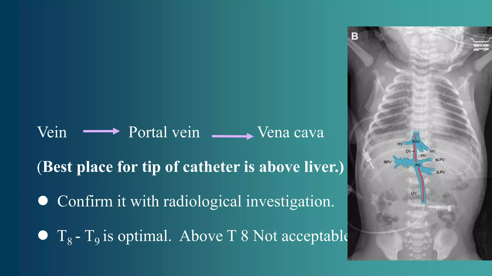 Neonatal procedures final | PPTX