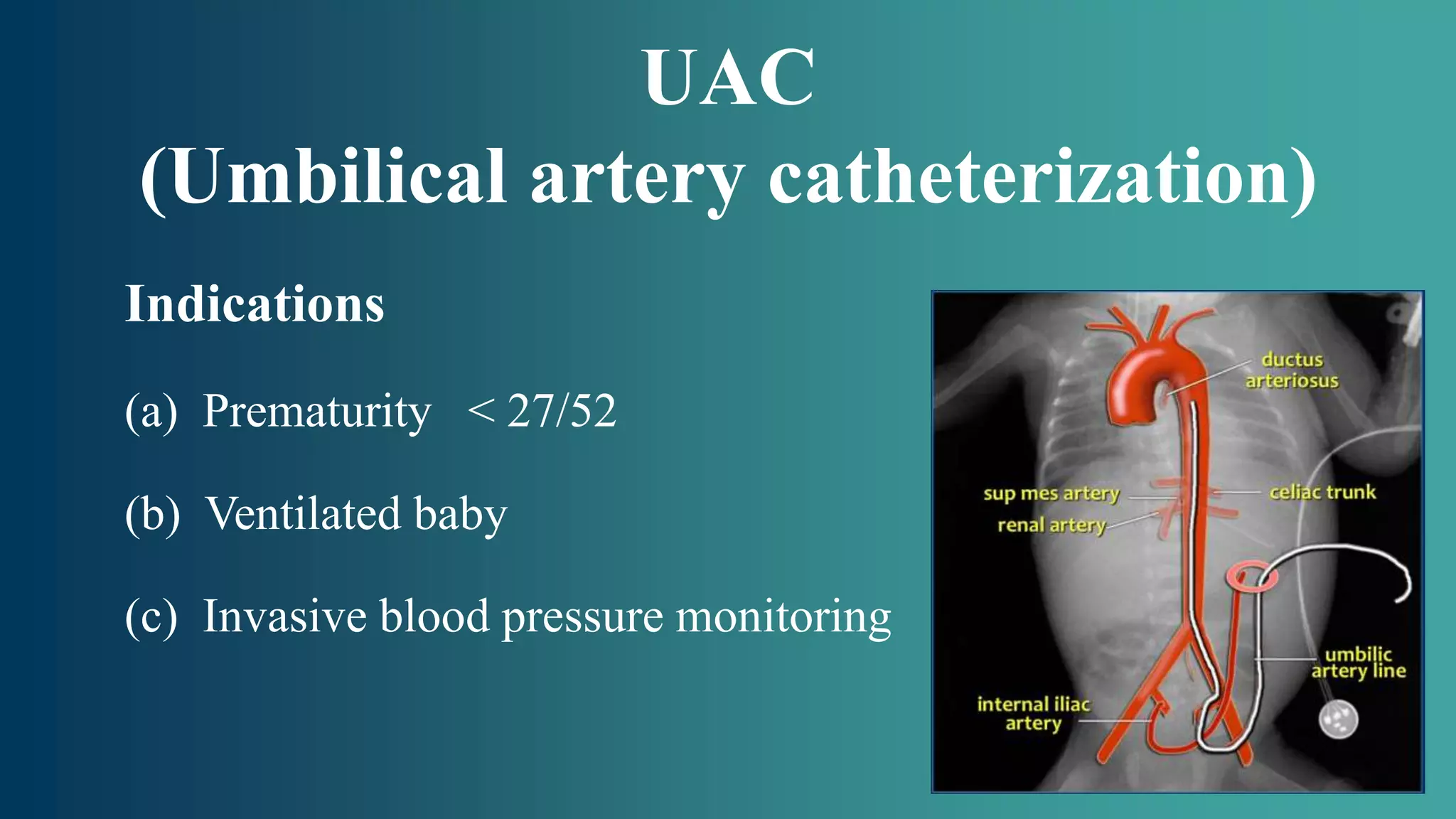 Neonatal procedures final | PPTX