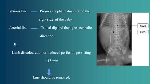 Neonatal procedures final | PPTX | Pregnancy | Reproductive Health