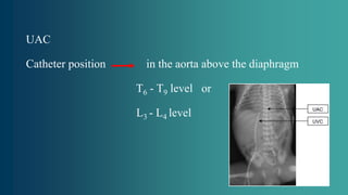 Neonatal procedures final | PPTX