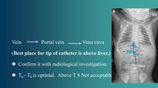 Neonatal procedures final | PPTX