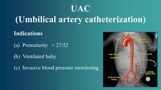 Neonatal procedures final | PPTX
