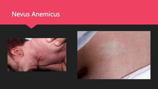 Rashes | PPT | Free Download