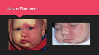 Rashes | PPTX