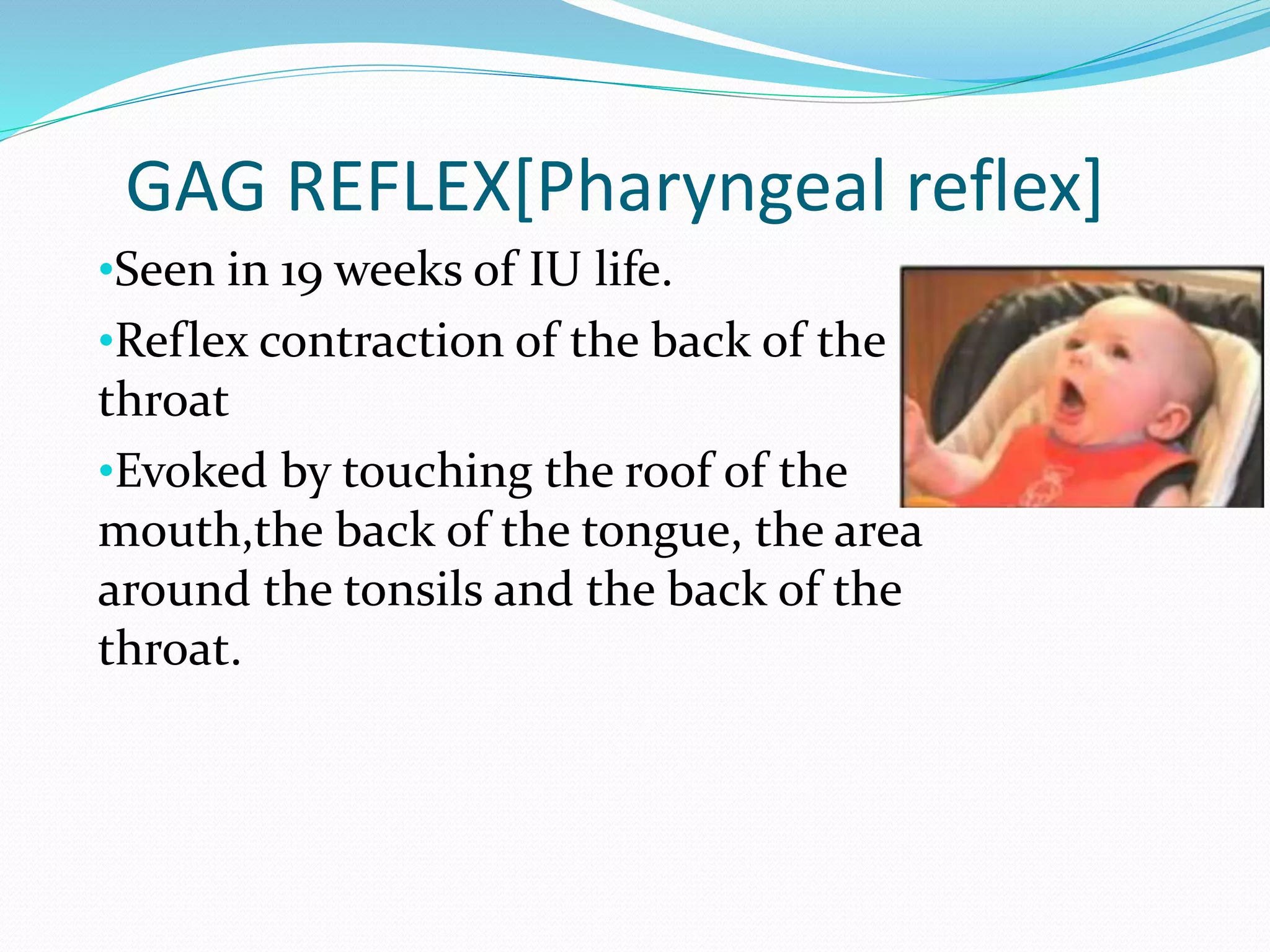 Neonatal Reflex | PPTX