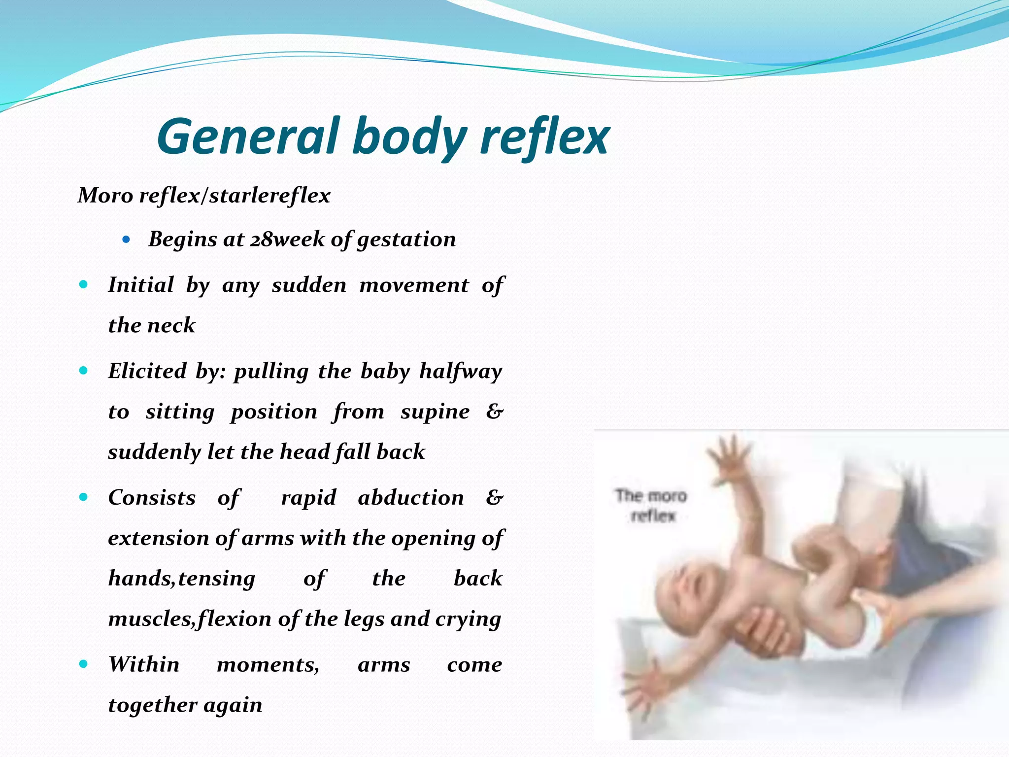 Neonatal Reflex | PPTX