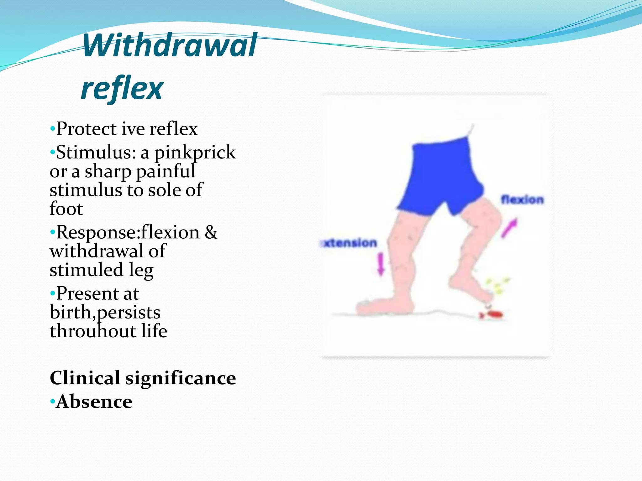Neonatal Reflex | PPTX