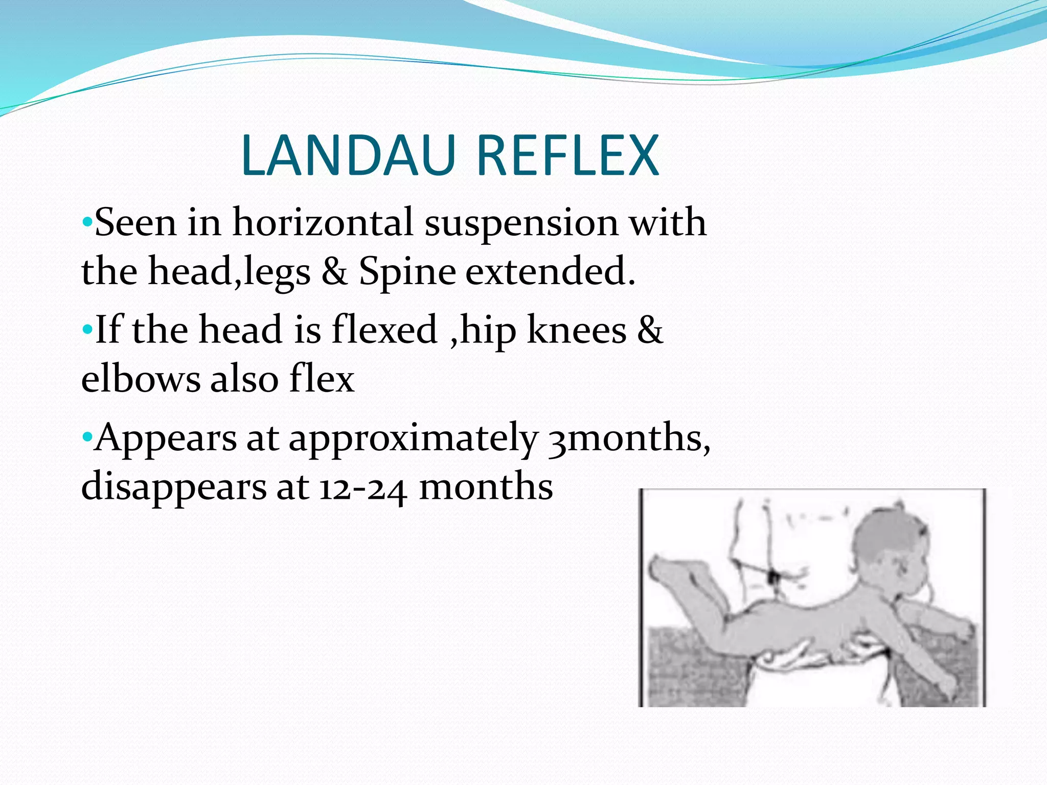 Neonatal Reflex | PPTX