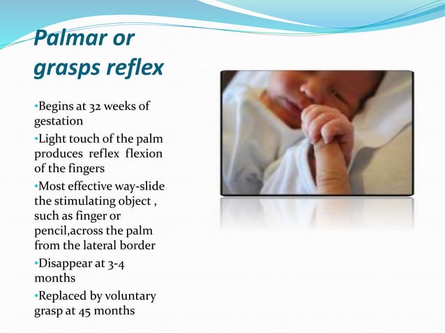 Neonatal Reflex | PPTX