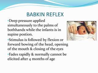 Neonatal Reflex | PPTX
