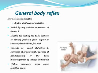 Neonatal Reflex | PPT