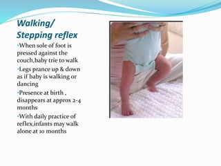 Placing Reflex