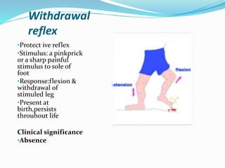 Flexor Withdrawal Reflex