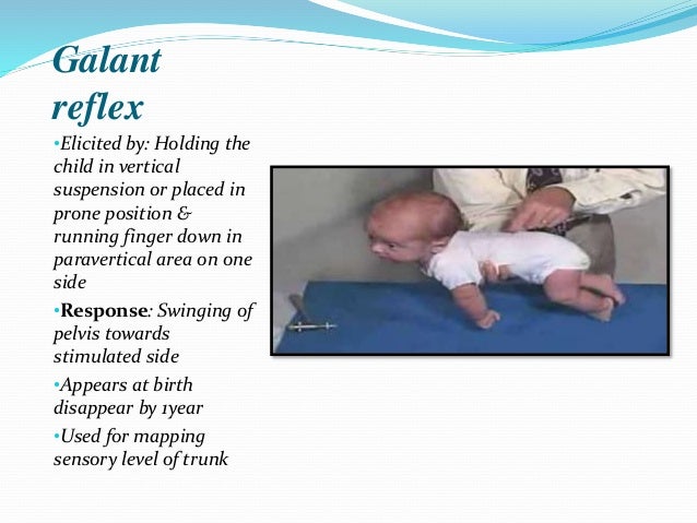 Neonatal Reflex