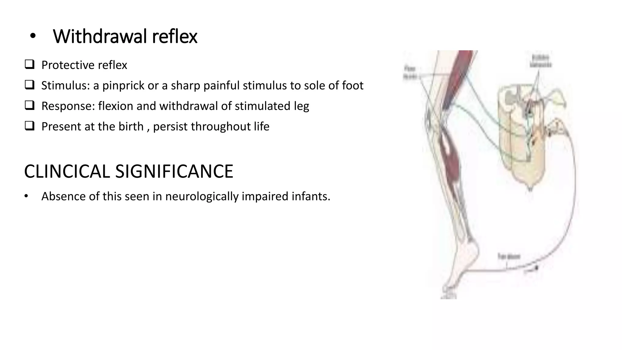 NEONATAL REFLEX.pptx