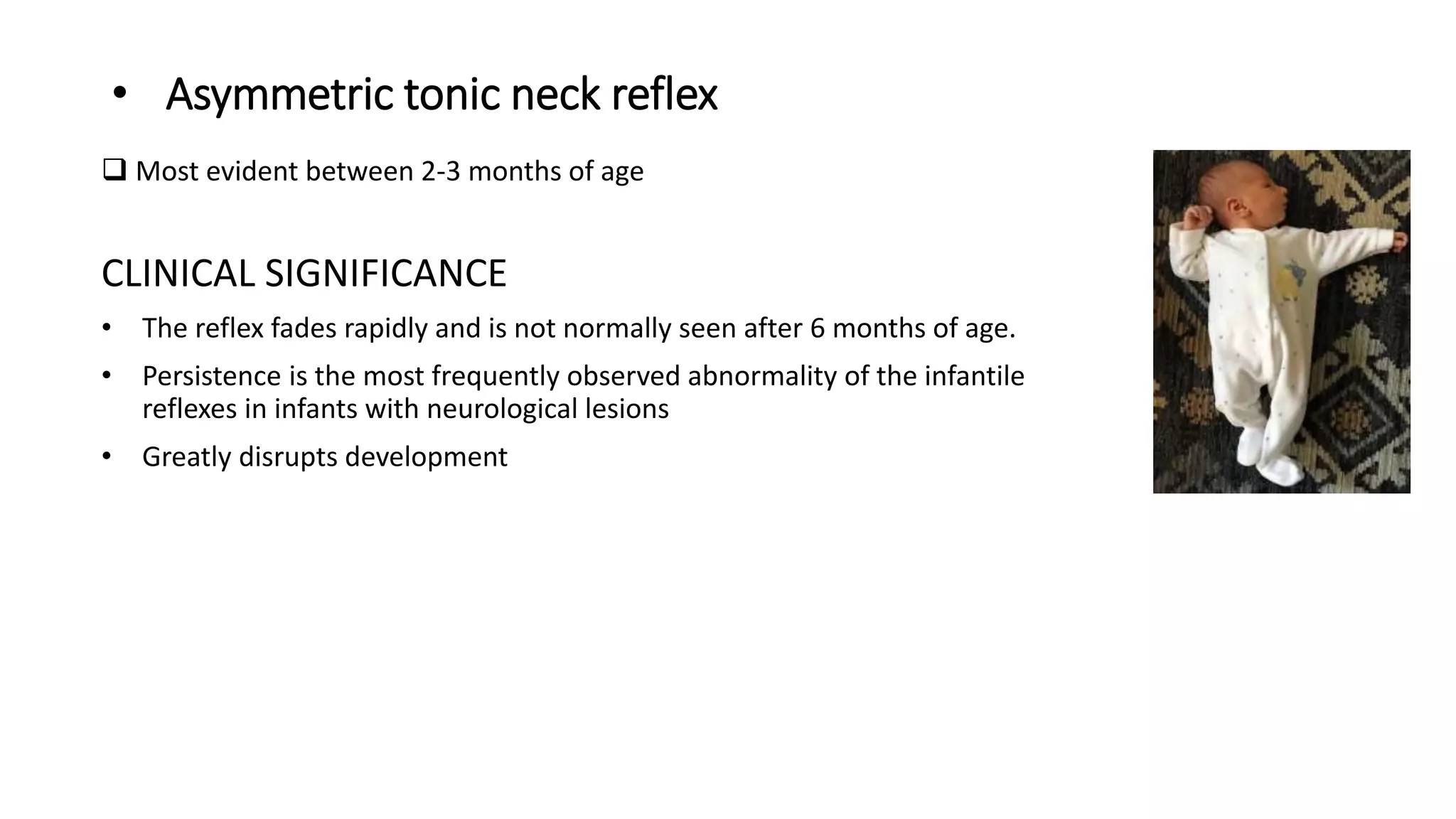 NEONATAL REFLEX.pptx