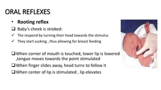 NEONATAL REFLEX.pptx