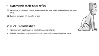 NEONATAL REFLEX.pptx