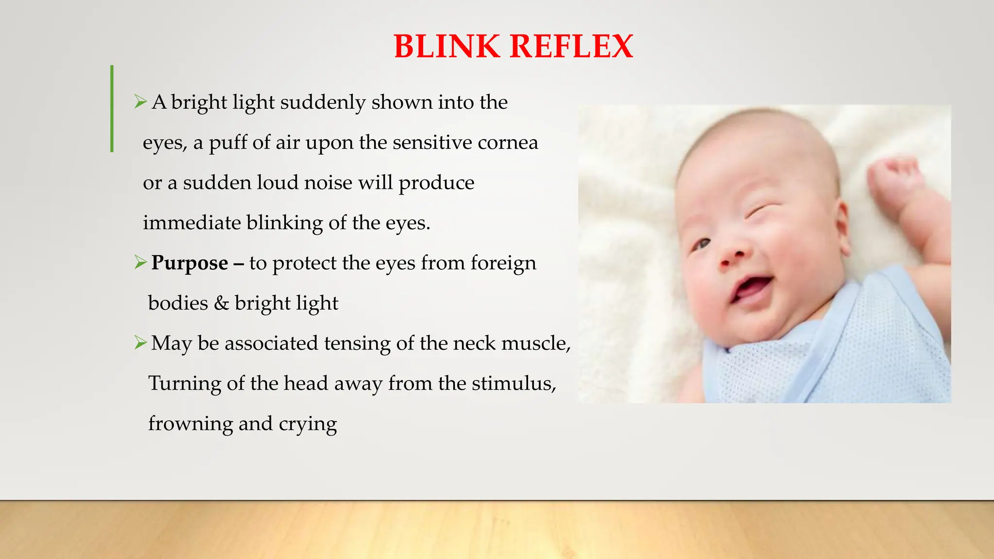 neonatal reflex.pptx