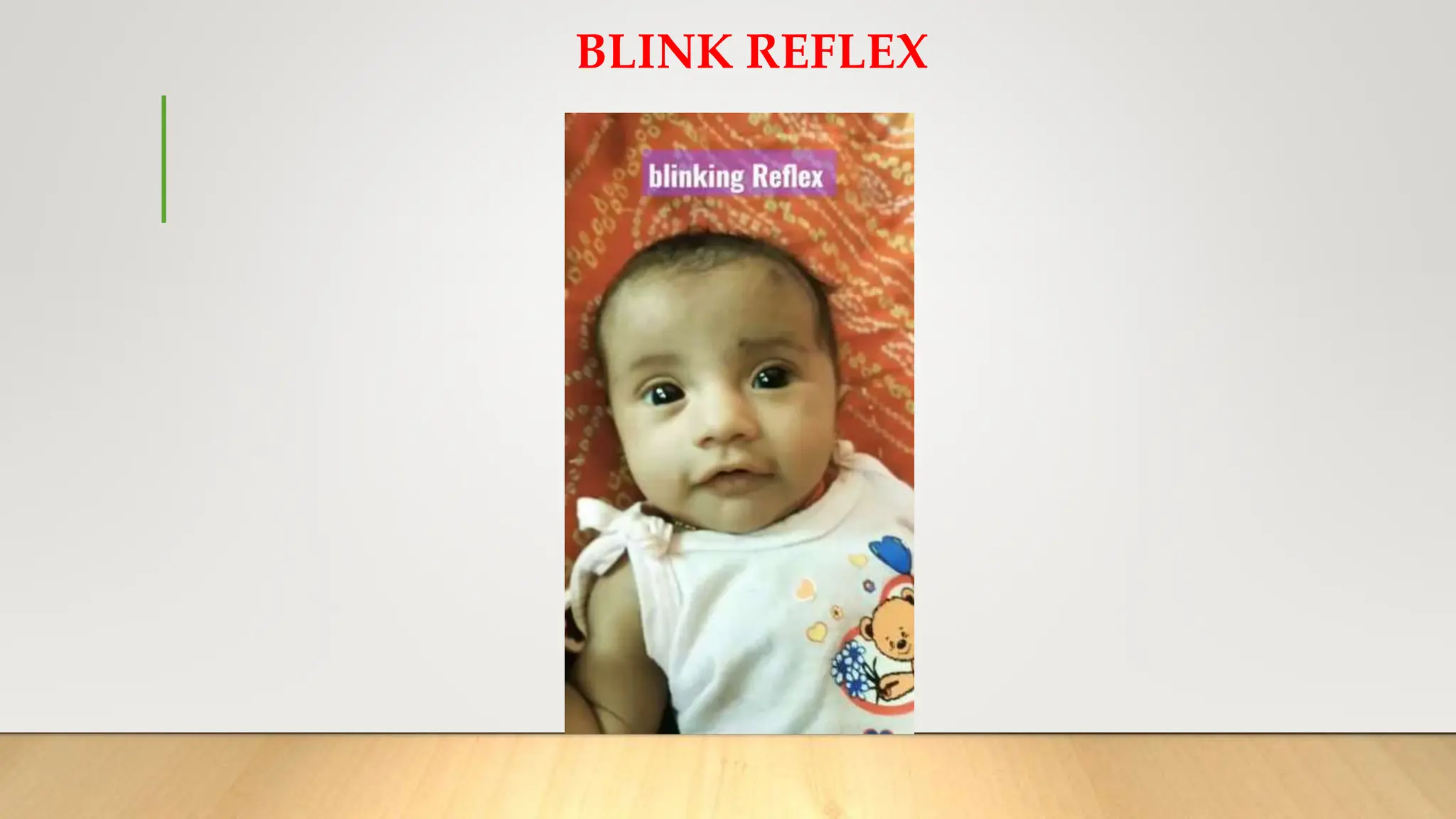neonatal reflex.pptx