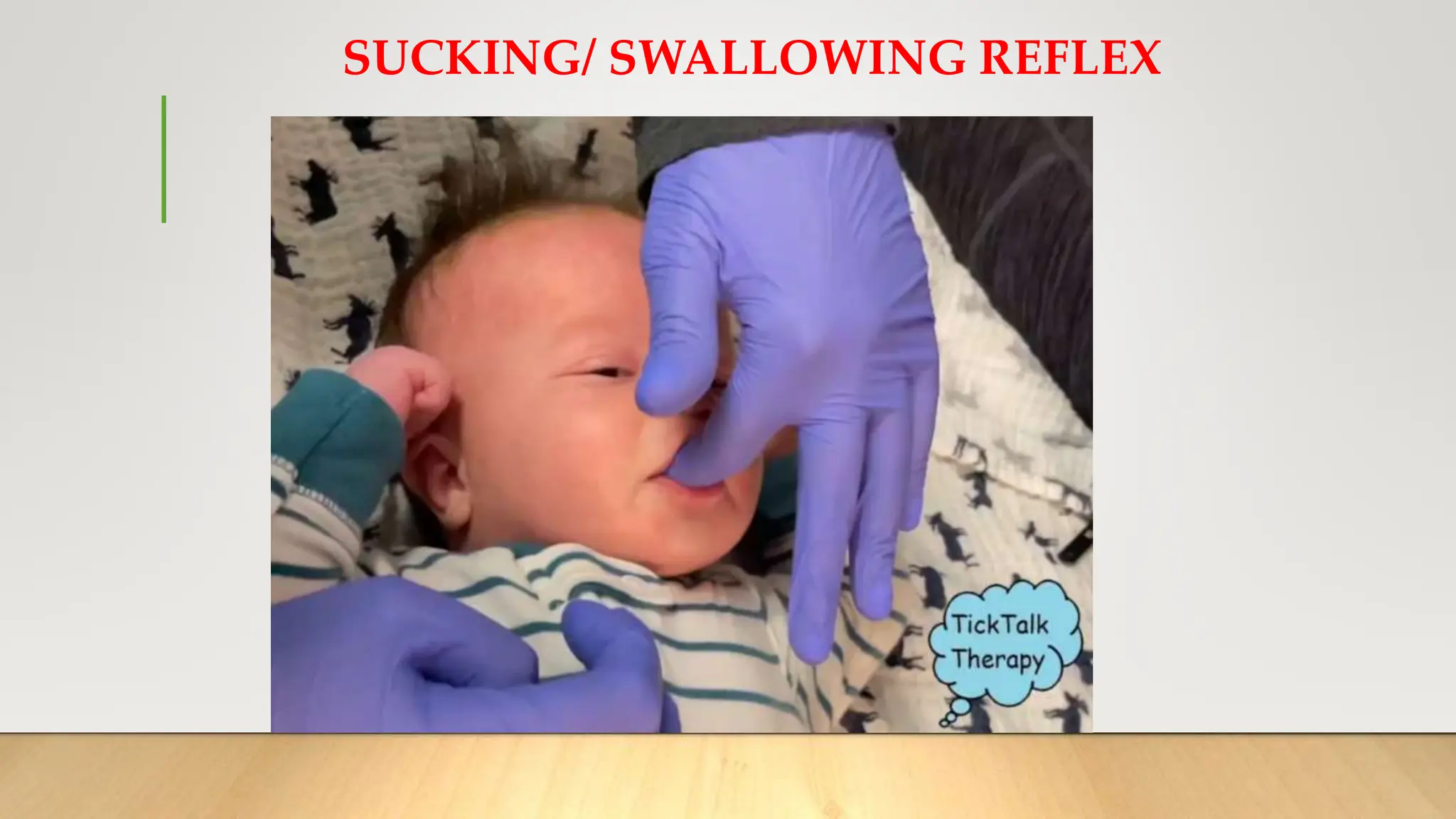 neonatal reflex.pptx