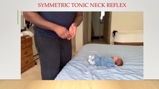 neonatal reflex.pptx | Pregnancy | Reproductive Health