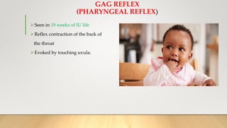 neonatal reflex.pptx