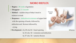 neonatal reflex.pptx | Pregnancy | Reproductive Health