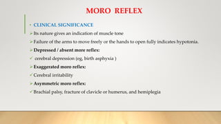 neonatal reflex.pptx