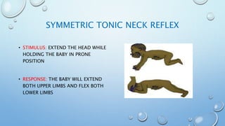 Neonatal reflexes | PPTX