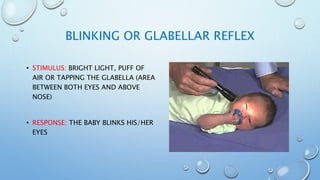 Neonatal reflexes | PPTX