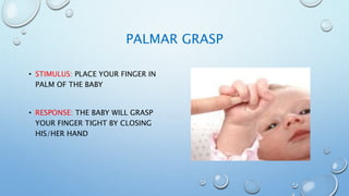 Neonatal reflexes | PPTX