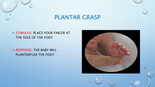 Neonatal reflexes | PPTX
