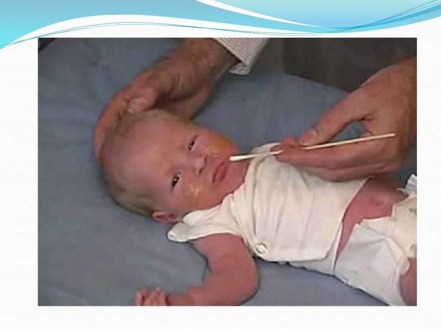 Neonatal reflexes by baneet | PPTX | Pregnancy | Reproductive Health