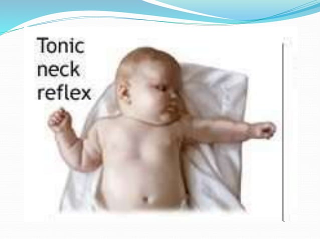 Neonatal reflexes by baneet | PPTX | Pregnancy | Reproductive Health