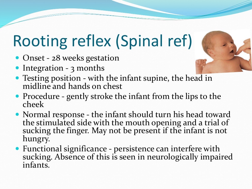 Neonatal reflexes by baneet